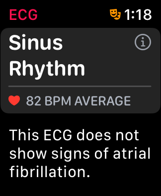 How to Take an ECG on the Apple Watch